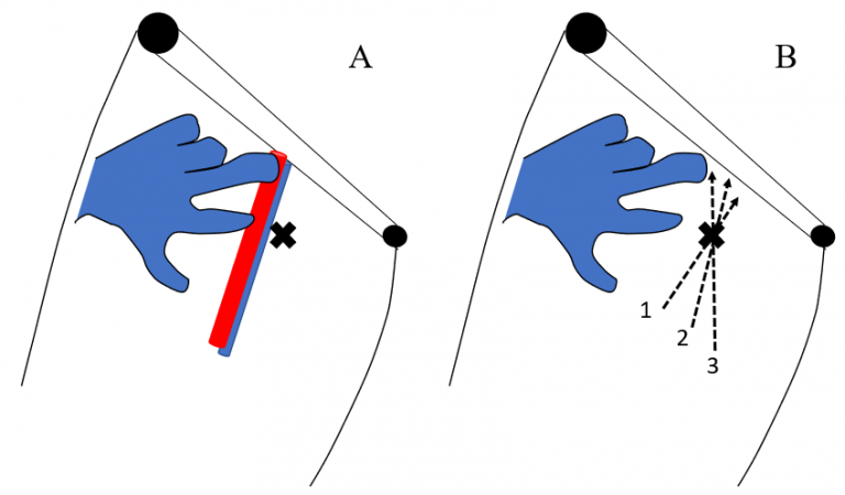 Getting Flash! The Blind “Fem” Line | ACOEP RSO