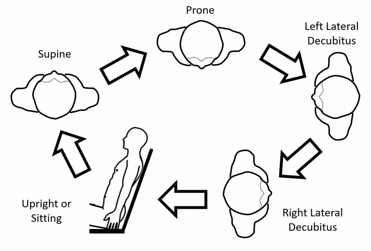 Awake Proning for COVID-19 Pneumonia | ACOEP RSO