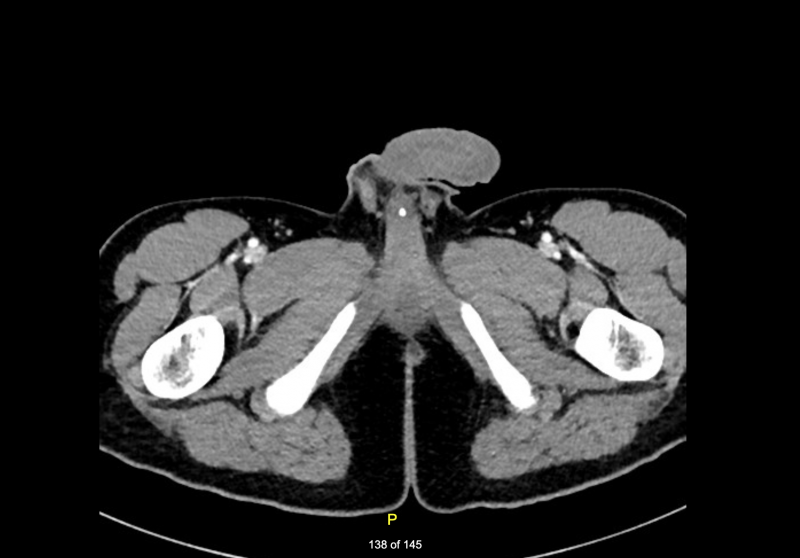 A Thing Not Looked for Is Seldom Found | ACOEP RSO
